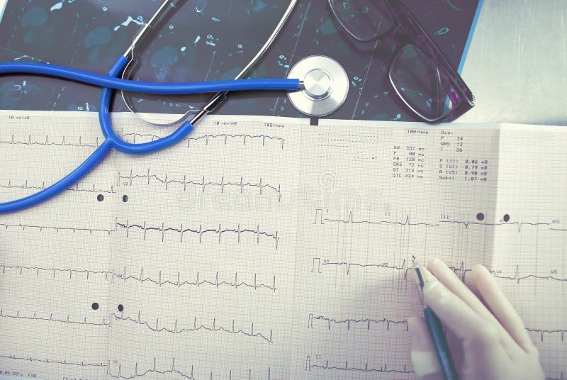 Table with Results of Health Tests in Doctors Office Stock Photo ...