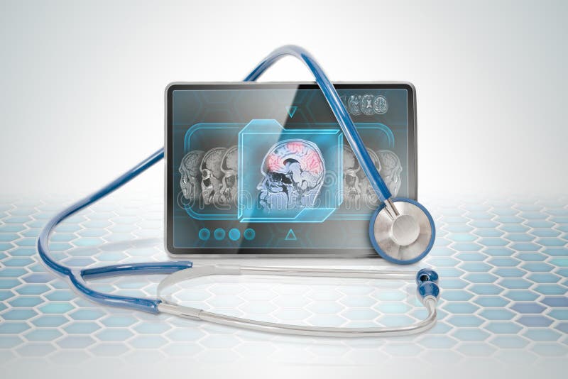 Brain activity MRI scan stock image. Image of clinical - 161794135