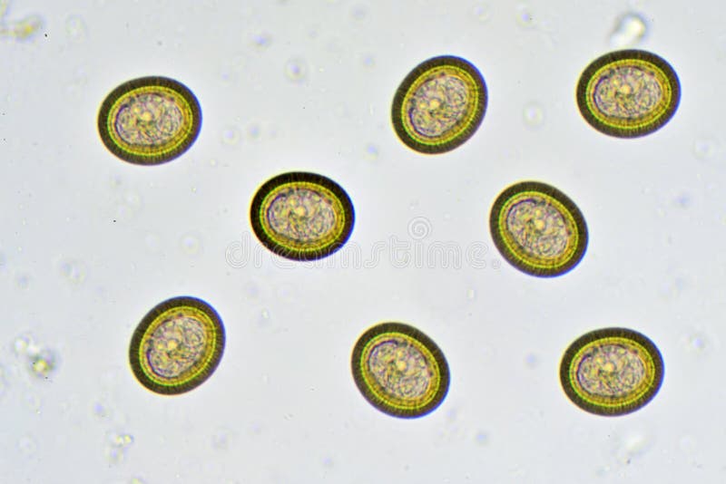 Eggs of Taenia or Tapeworm in Human Stool Stock Photo - Image of ...