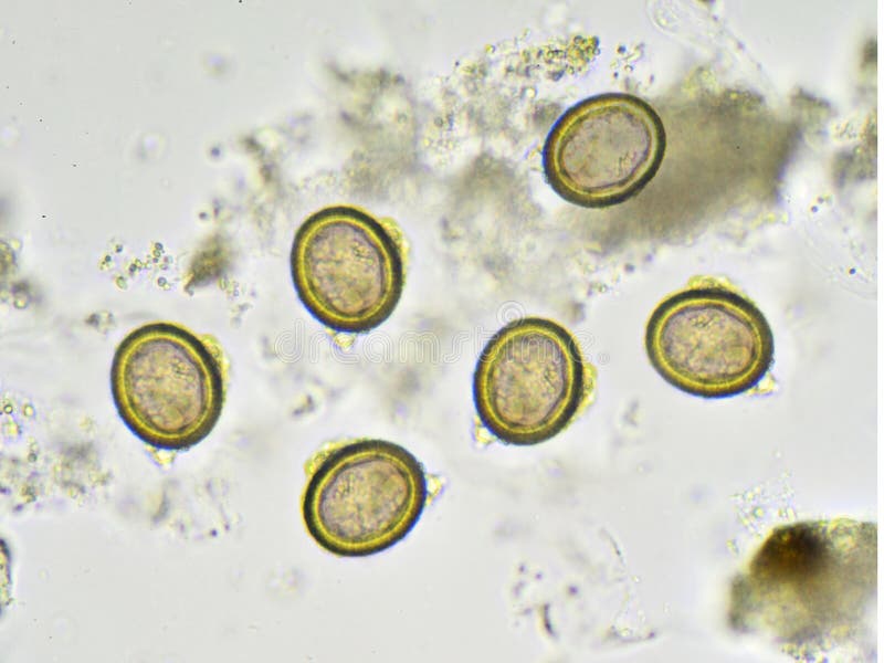 Taenia in stool stock photo. Image of disease, taenia - 96910454