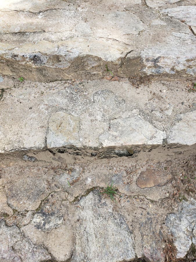 Taking Steps Toward Recovery. a Caring Physiotherapist Helping His ...