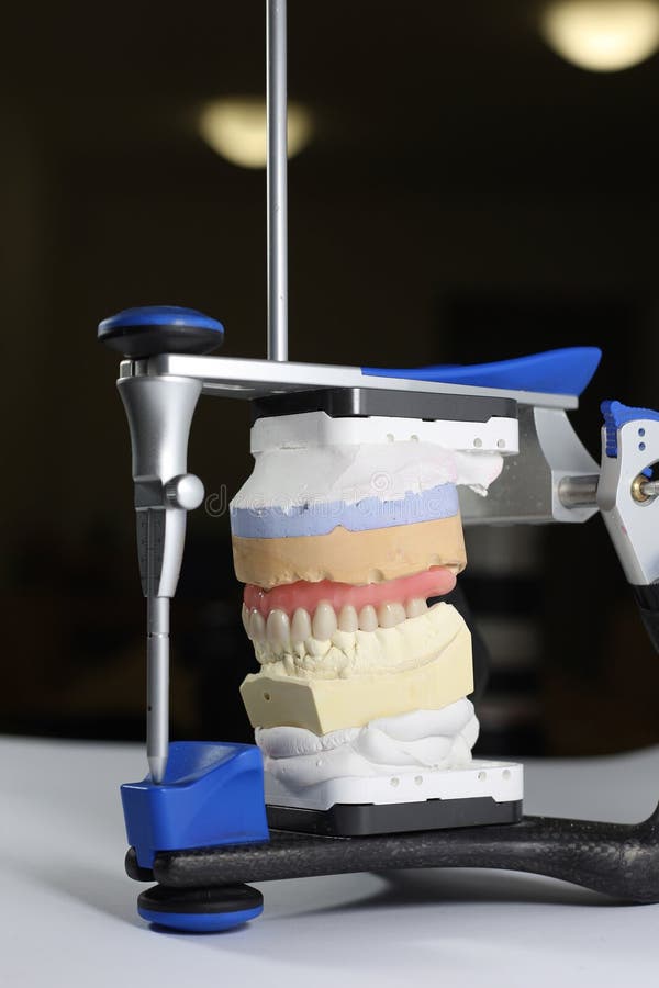 Het Malen Van De Tandtechnicus Stock Foto - Image of mondeling, plaats ...