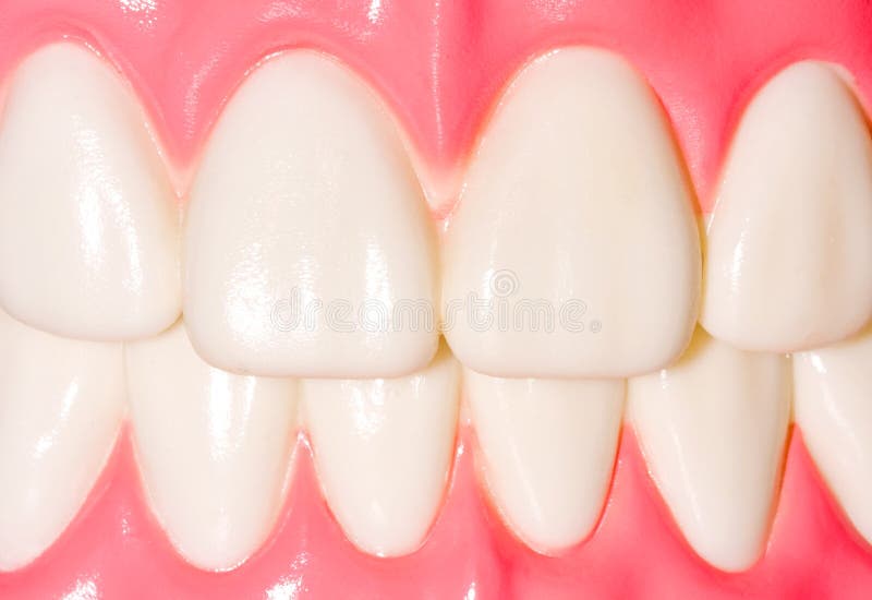 Tand model stock foto. Image of tand, medisch, prothese - 29620846