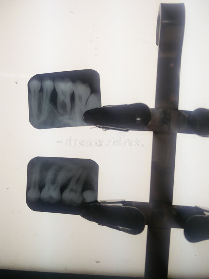 Tand nummering stock foto. Image of tand, nummering - 112200190
