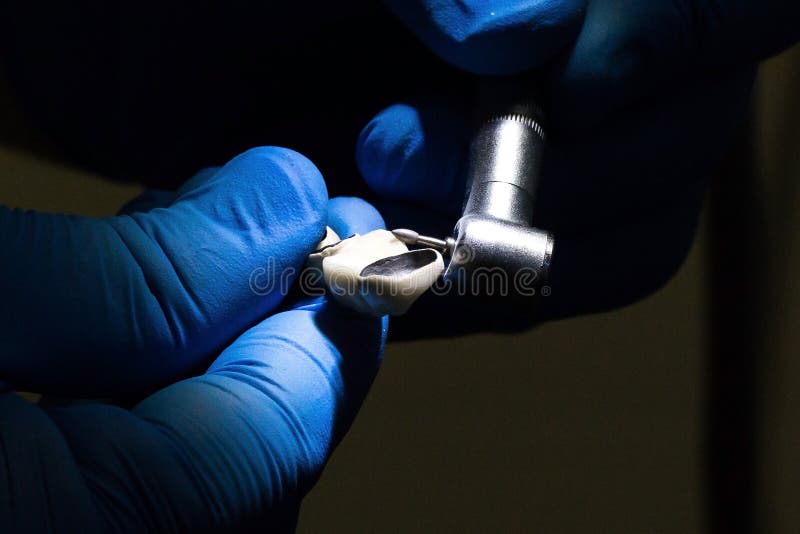 Tandprothese, Gebitten, Prosthetics Het Werk Stock Afbeelding - Image ...