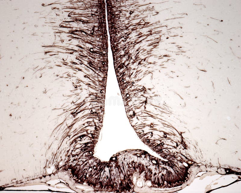 Valonia Ventricosa Cross Section