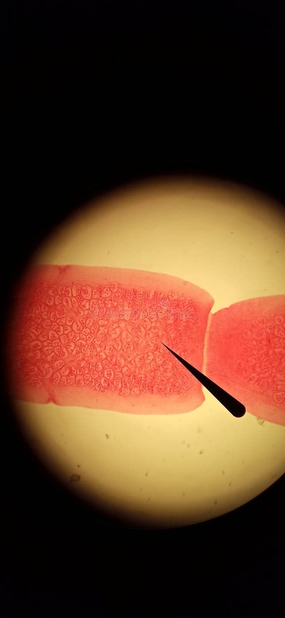 Tapeworm Segment Microscope View Stock Photo - Image of skin, segment ...