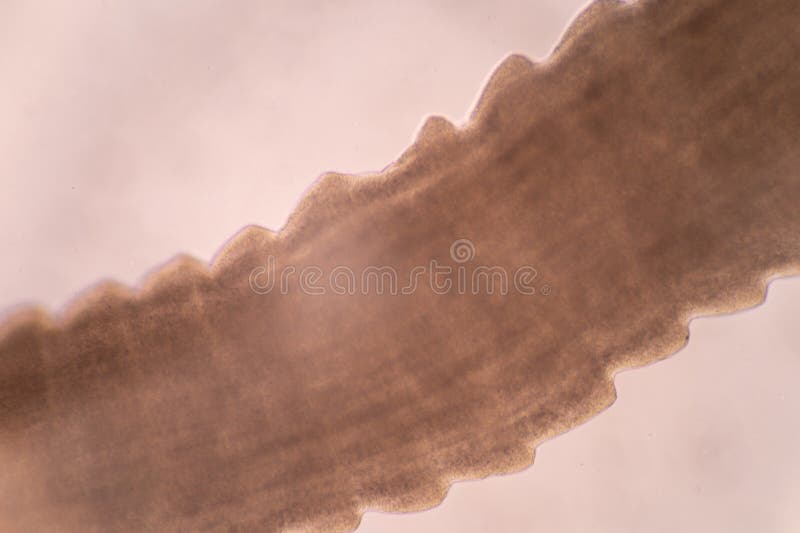 Tapeworms (Cestoda: Caryophyllidea), Parasites of Fish Under the ...