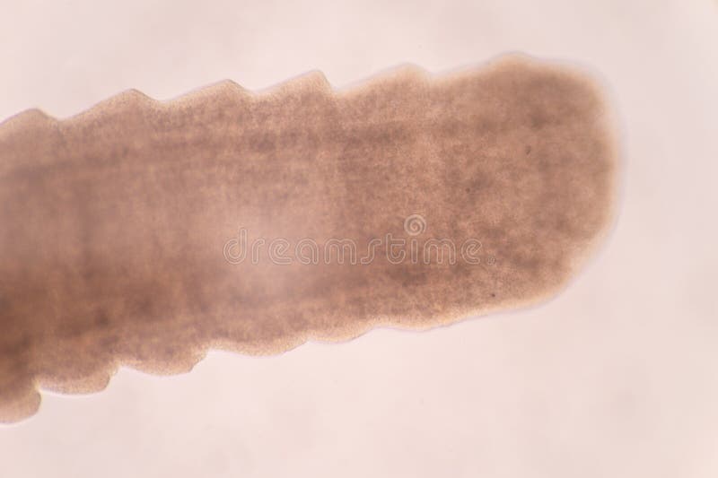 Tapeworms (Cestoda: Caryophyllidea), Parasites of Fish Under the ...