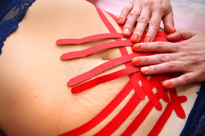 Taping Procedure. Method of Rejuvenation Band-aid. Overlay Process ...