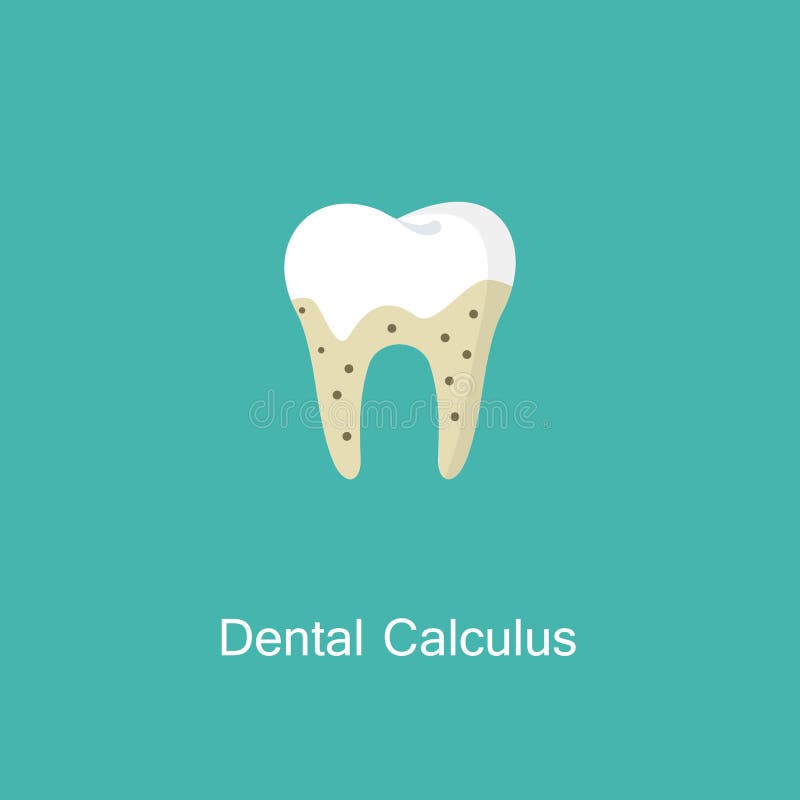 Tartar or Calculus Teeth Illustration Vector Icon. Stock Vector ...