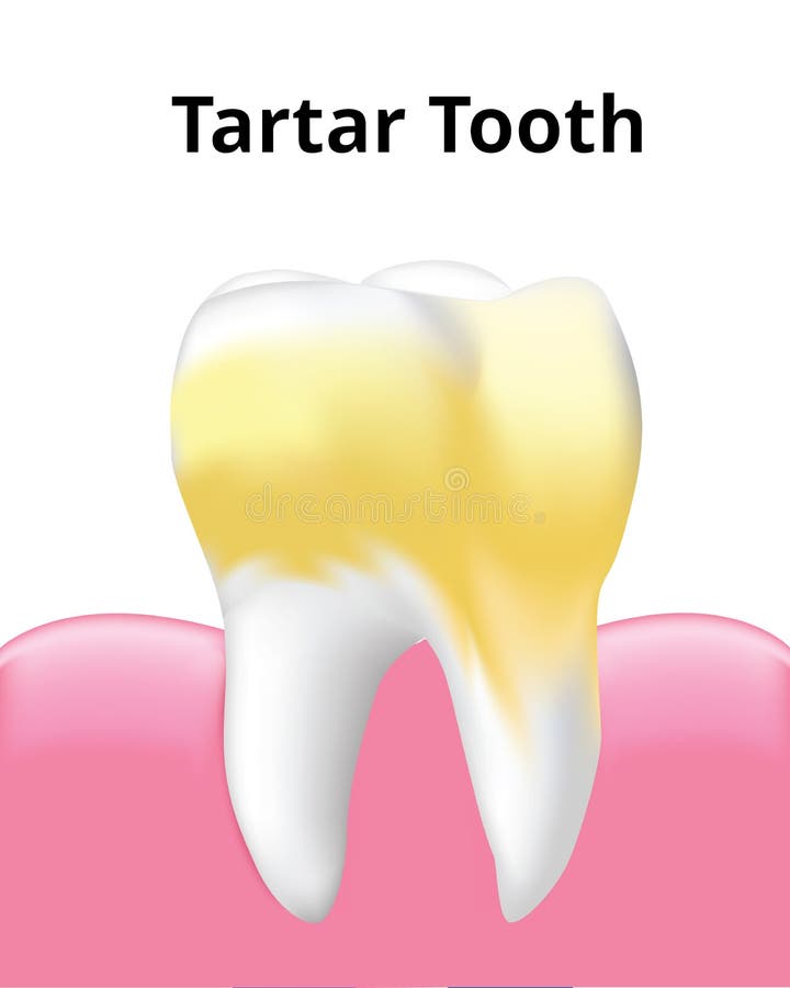 Tartar Stock Illustrations – 715 Tartar Stock Illustrations, Vectors ...