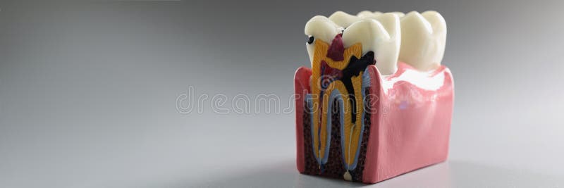 Teaching Model of a Tooth in Cross Section, Close-up Stock Image ...