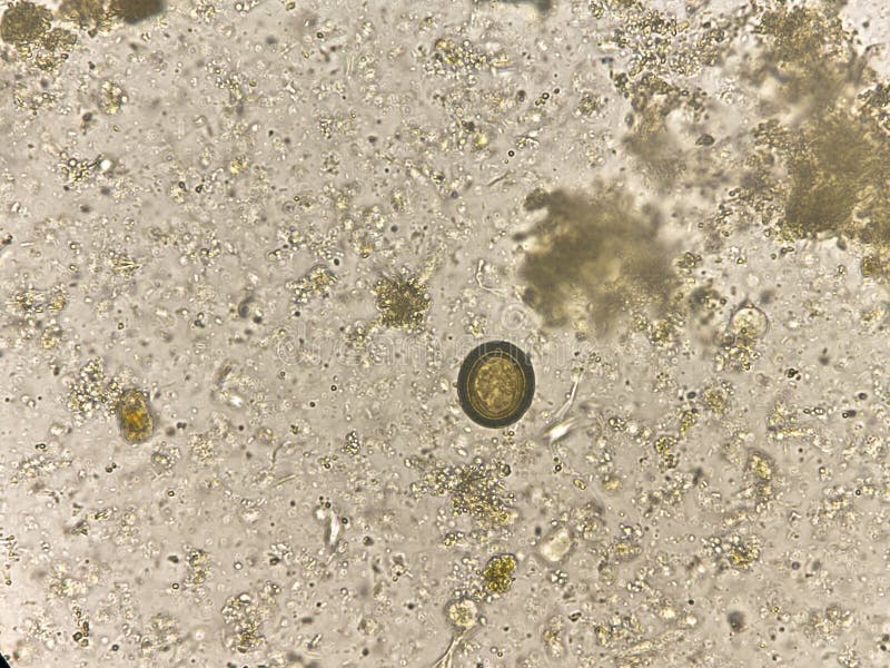 Teania Egg Human Parasite in Stool Stock Image - Image of nature ...