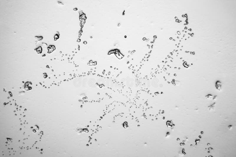 Tears Viewed at the Microscope Stock Image - Image of background ...