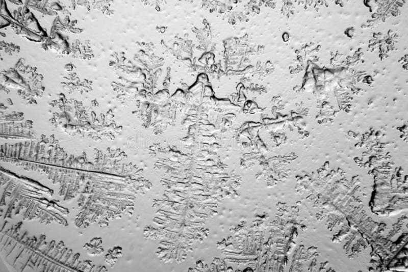 Tears Viewed at the Microscope Stock Image - Image of pain, human ...