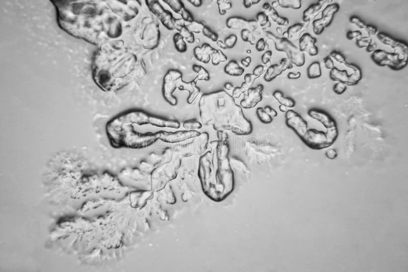 Tears Viewed at the Microscope Stock Photo - Image of glass, textures ...