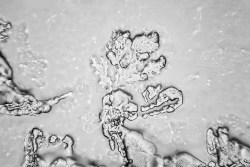 Tears Viewed at the Microscope Stock Image - Image of texture, slide ...