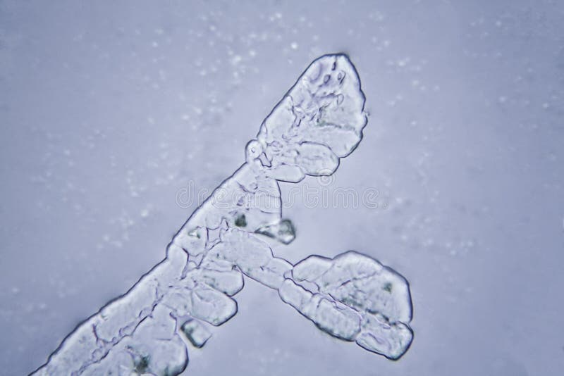 Tears Viewed at the Microscope Stock Photo - Image of viewed, white ...