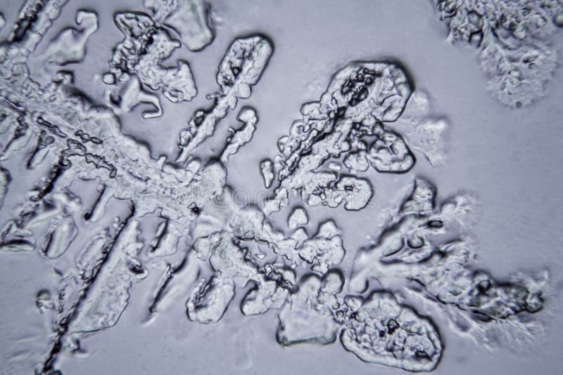 Tears Viewed at the Microscope Stock Photo - Image of human, loss ...