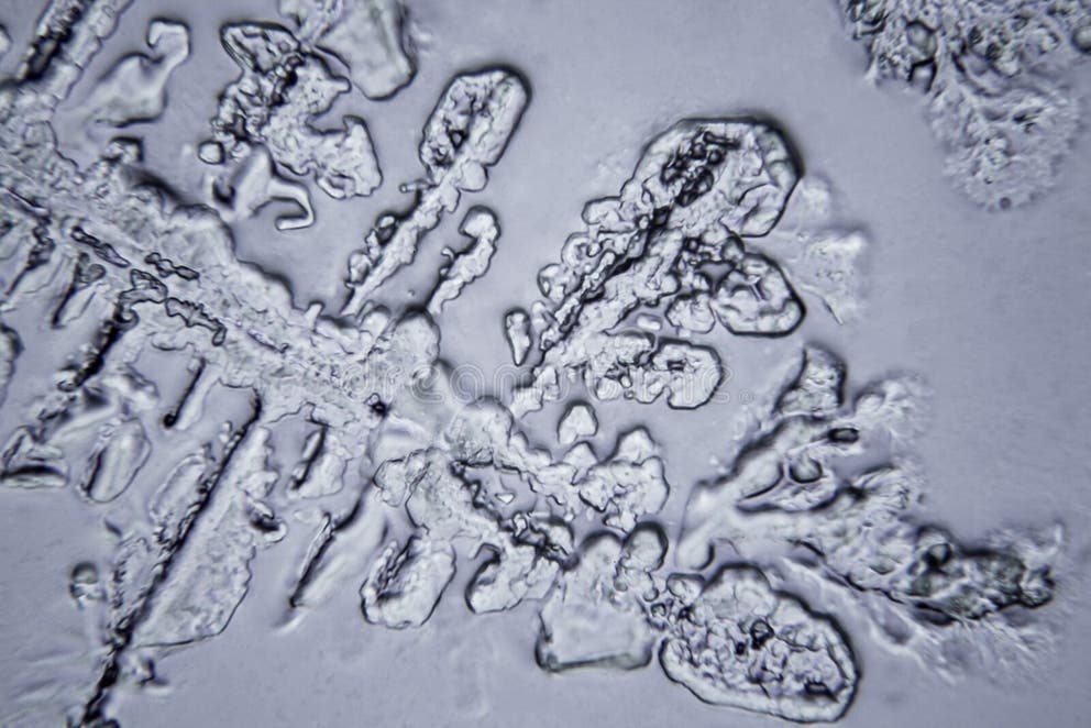 Tears Viewed at the Microscope Stock Photo - Image of human, loss ...