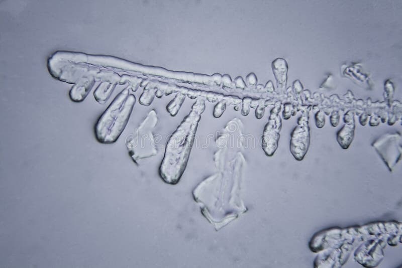 Tears Viewed at the Microscope Stock Photo - Image of health, 1001000xn ...