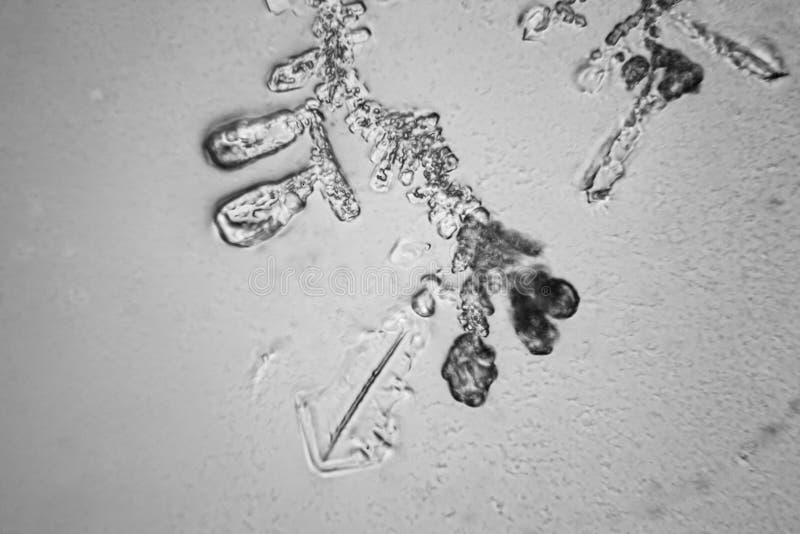 Tears Viewed at the Microscope Stock Image - Image of glass, microscope ...