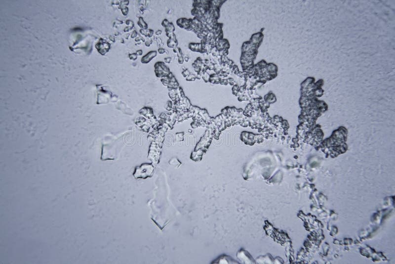 Tears Viewed at the Microscope Stock Image - Image of viewed, glass ...