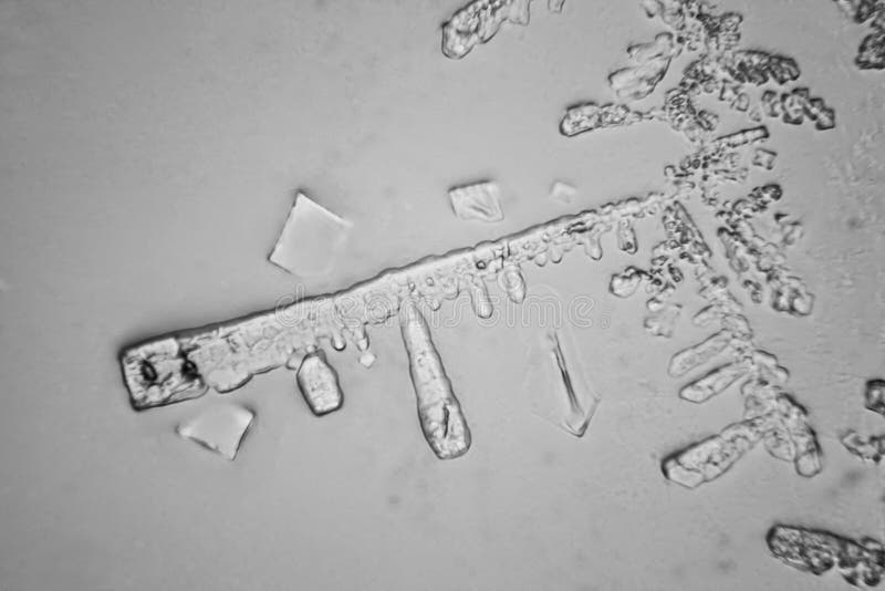 Tears Viewed at the Microscope Stock Image - Image of technology ...