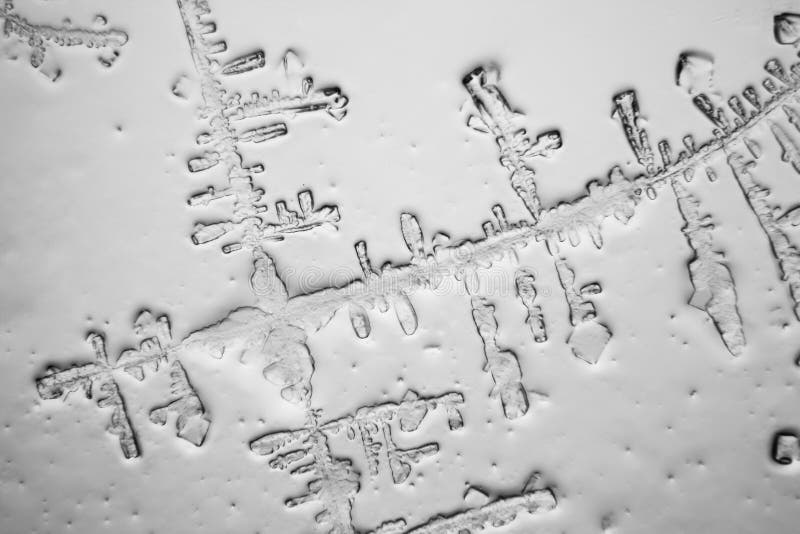 Tears Viewed at the Microscope Stock Image - Image of sadness ...