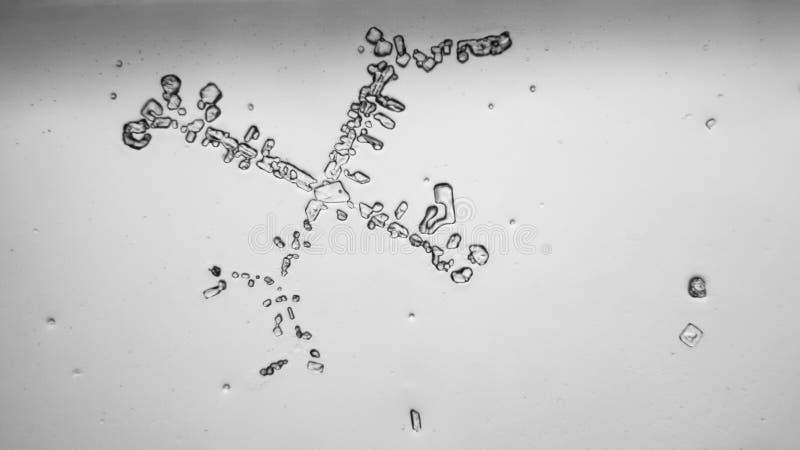 Tears Viewed at the Microscope Stock Image - Image of laboratory ...