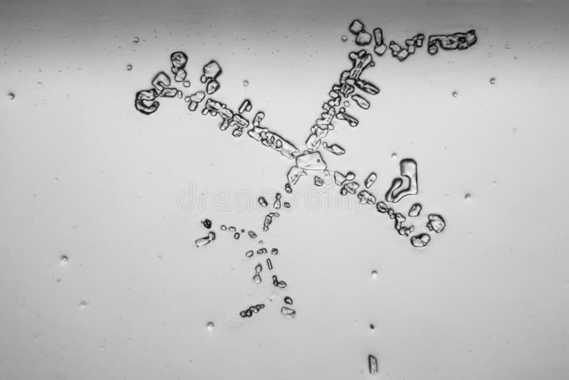 Tears Viewed at the Microscope Stock Image - Image of medicine, tear ...
