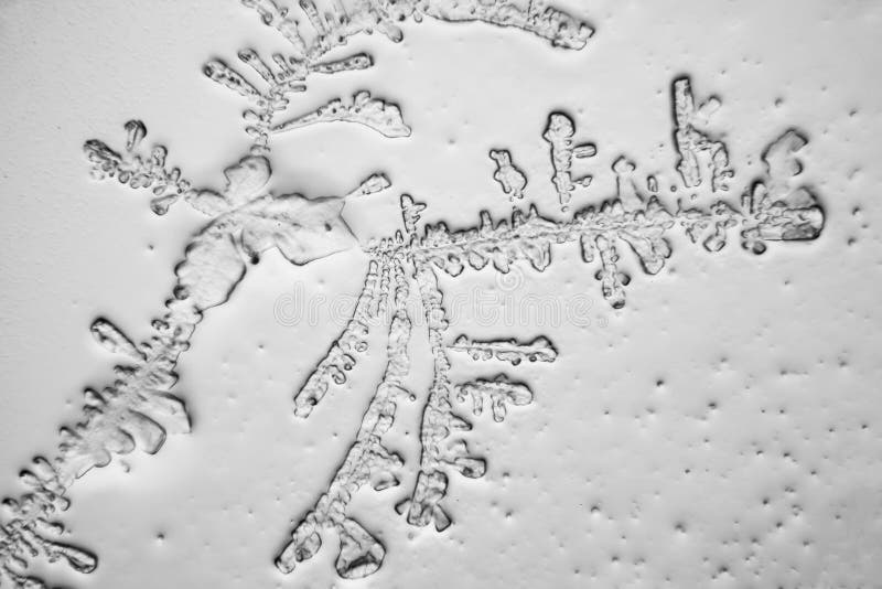 Tears Viewed at the Microscope Stock Photo - Image of detail, pain ...