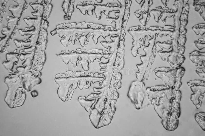 Tears Viewed at the Microscope Stock Photo - Image of human, slide ...