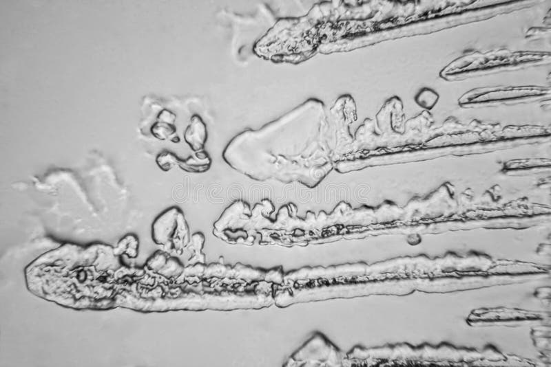 Tears Viewed at the Microscope Stock Photo - Image of human, technology ...