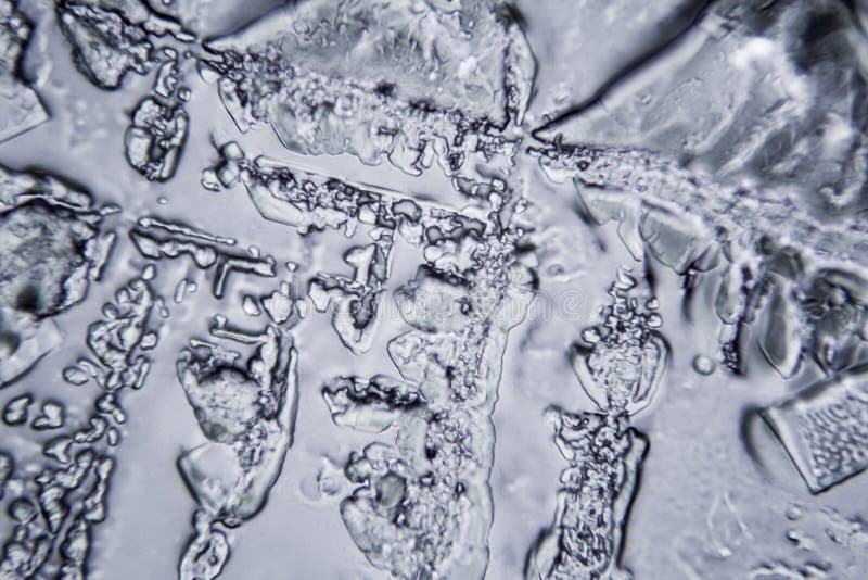 Tears Viewed at the Microscope Stock Image - Image of liquid, eyes ...