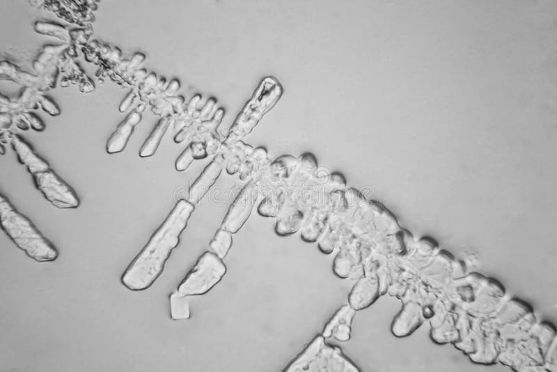 Tears Viewed at the Microscope Stock Image - Image of tear, cell: 121224247