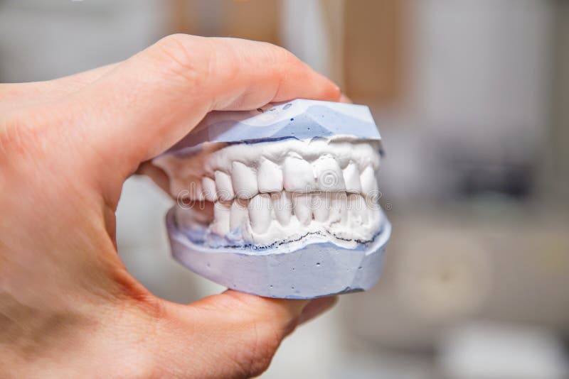 Technical Shots on a Dental Prothetic Laboratory Stock Image - Image of ...