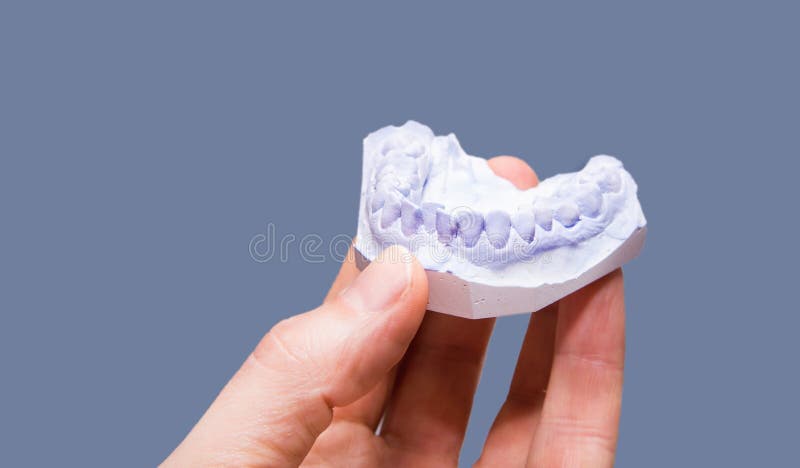 Technical Shots on a Dental Prothetic Laboratory Stock Image - Image of ...