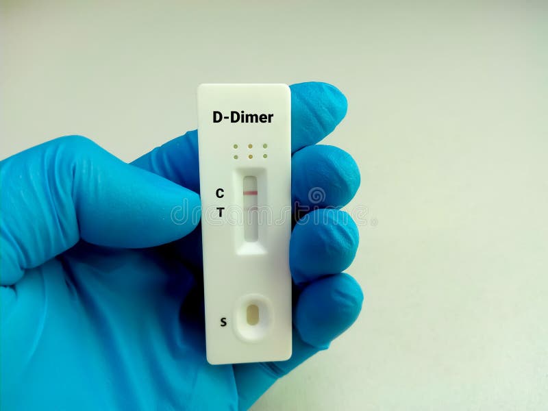 Device for D-Dimer Rapid Screening Test. Stock Image - Image of corona ...