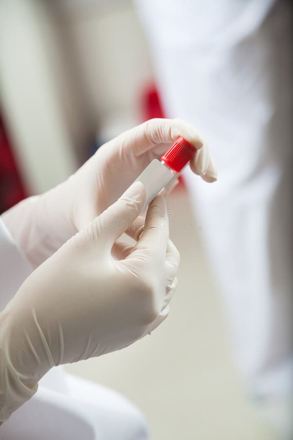 Technician Labeling Test Tube in Lab Stock Photo - Image of science ...