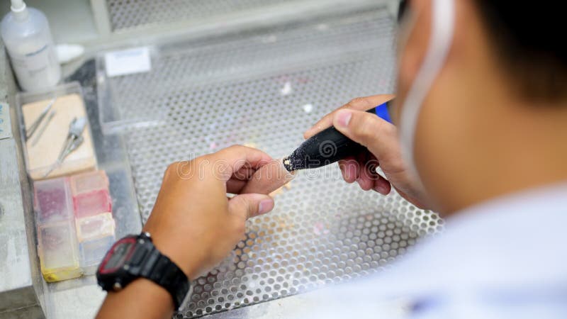 Technician Making Prosthetic Device Using Grinder To Smooth Socket ...
