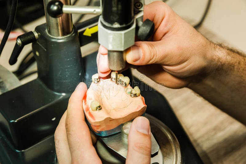 Technician Operating Dental Drill on Dental Mold in Lab Stock Photo ...