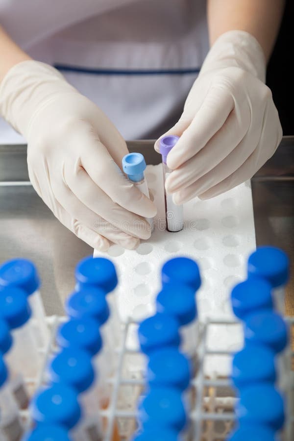 Technician Placing Test Tube Samples in Tray Stock Image - Image of ...