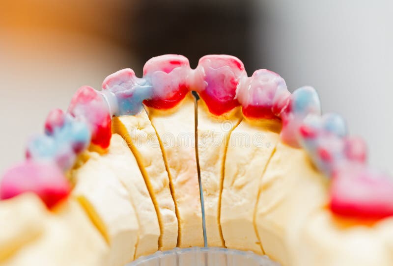 Technician s work stock image. Image of bridges, dentist - 32450151