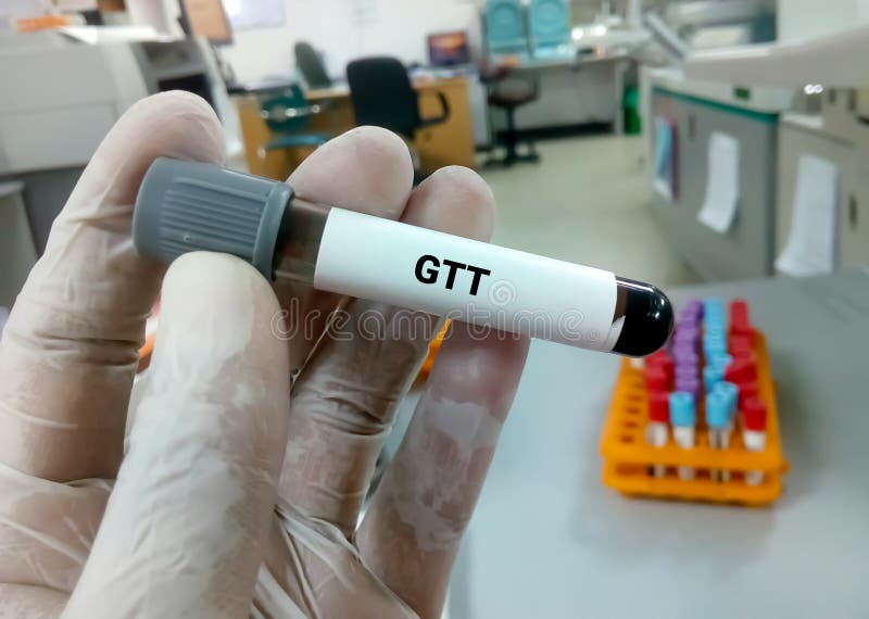 Technician or Scientist Hold a Sample Tube of Glucose Tolerance Test or ...