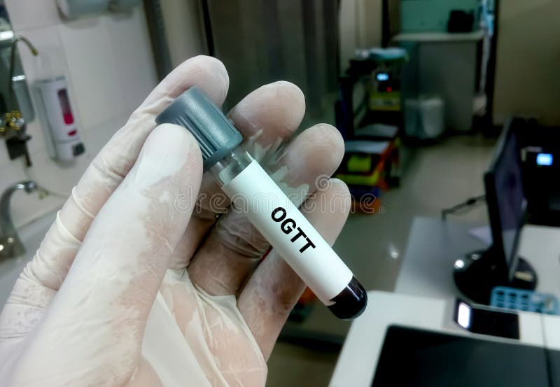 Technician or Scientist Hold a Sample Tube of Oral Glucose Tolerance ...