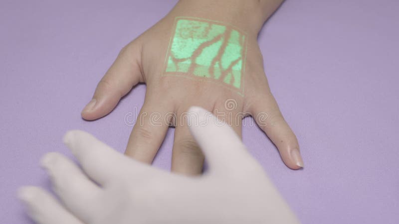 A Technician Utilizing a Vein Scanner Apparatus on a Patient. Stock ...