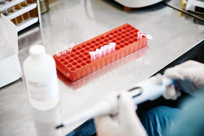 Technician Works Investigating Analysis Sample in Test Tubes Stock ...