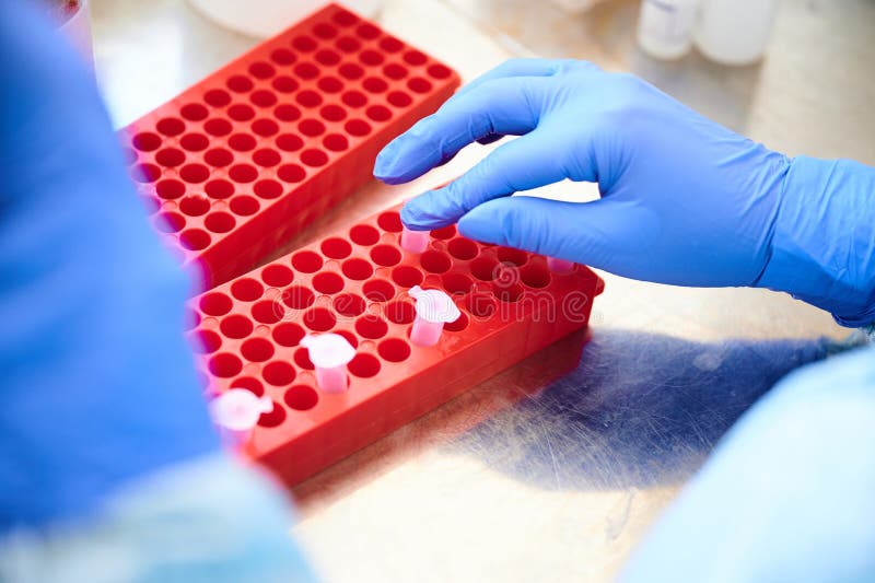 Technician Works Investigating Analysis Sample in Test Tubes Stock ...